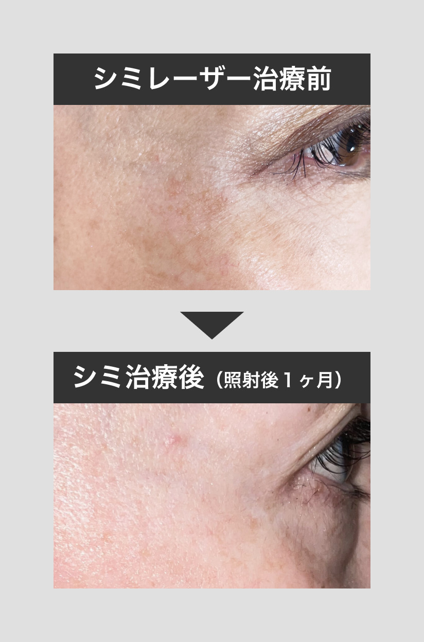 症例一覧 - 東京・大阪の美容皮膚科ならFLALU（フラルクリニック）