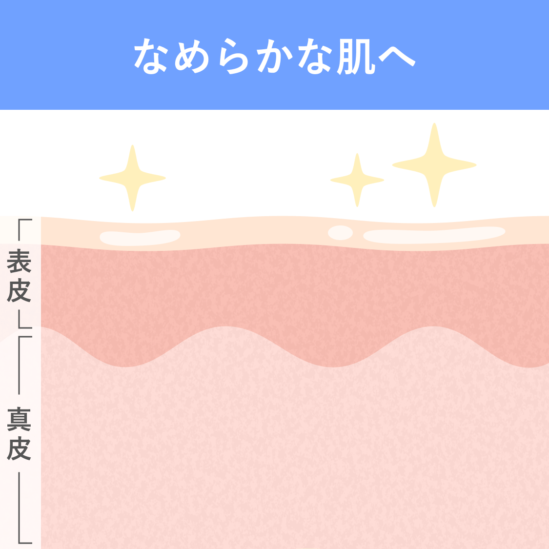 ニキビ跡・毛穴治療に効果的ダーマペン4（東京浜松町院） - 東京・大阪の美容皮膚科ならFLALU（フラルクリニック）